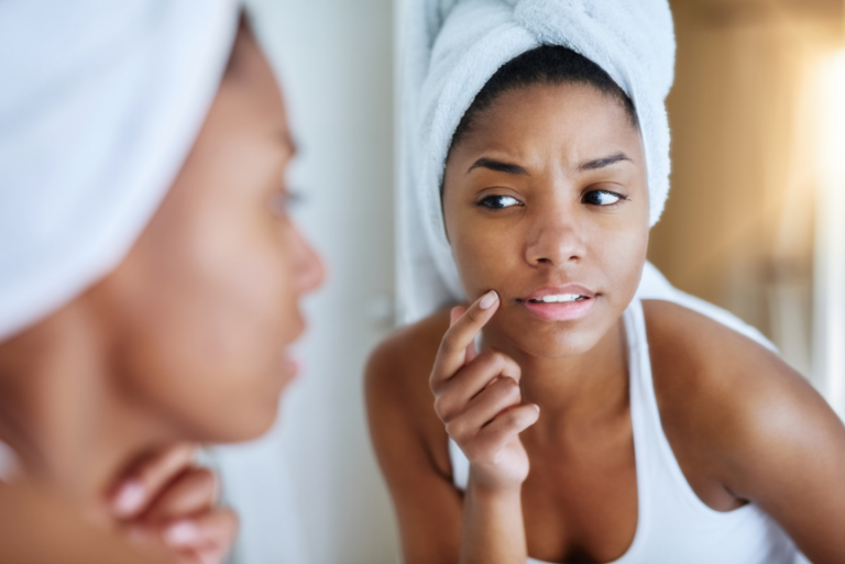 Holiday Stress & Breakouts | Washington DC Dermatology Experts